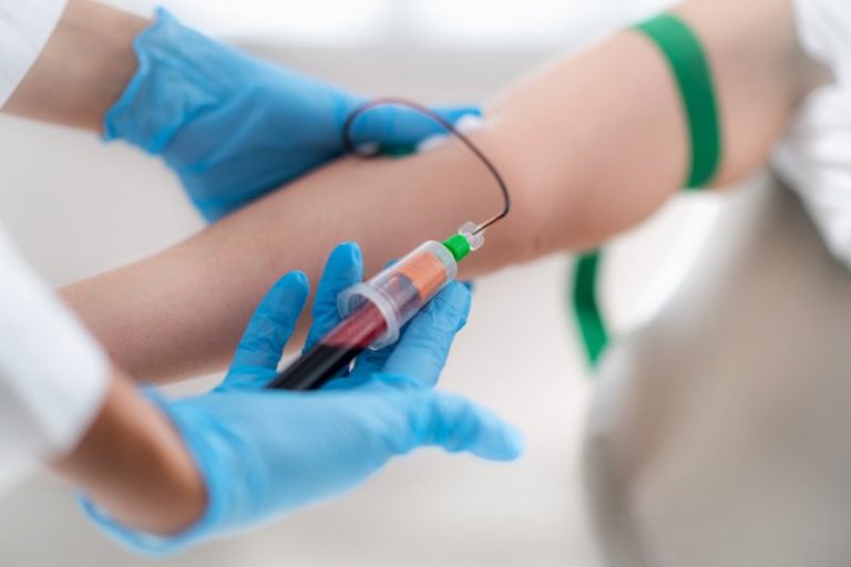 Blood: Why Is Blood Red? How Much Blood Does A Human Produce Per Day ...
