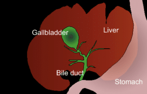 Amazing Facts You Should Know About Bilious Vomiting [Detailed Guide ...