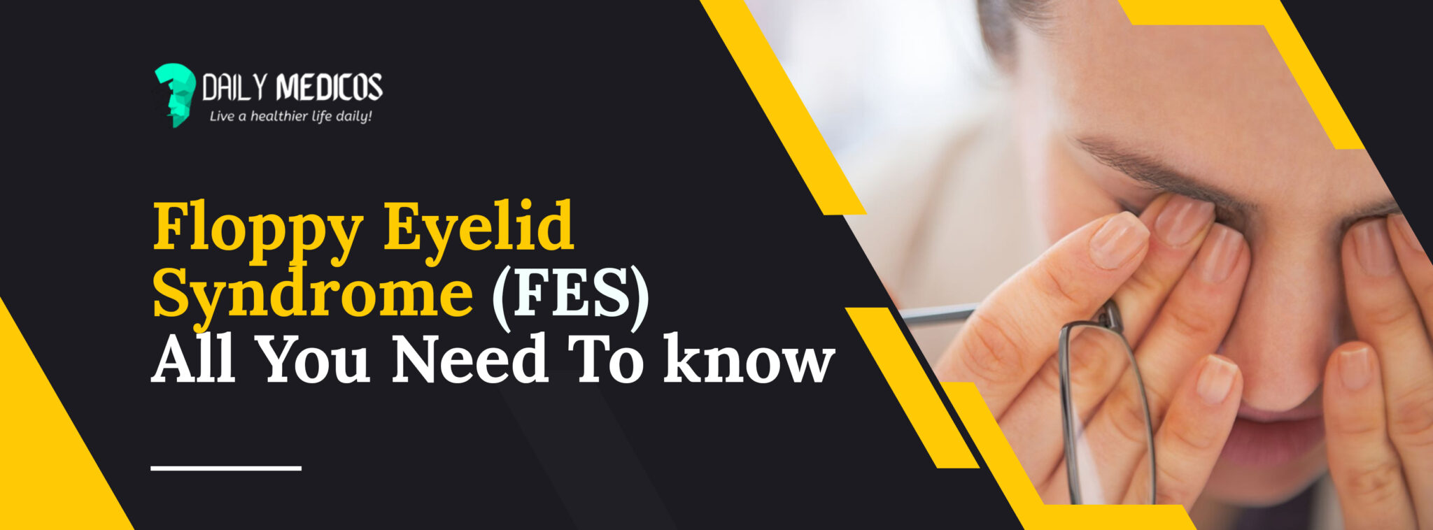 Floppy Eyelid Syndrome (FES): Causes, Symptoms, & Treatment - Daily Medicos