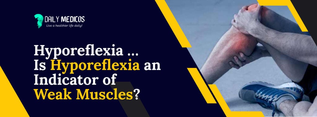 Hyporeflexia ...Is Hyporeflexia an Indicator of Weak Muscles? - Daily ...