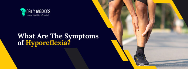 Hyporeflexia ...Is Hyporeflexia an Indicator of Weak Muscles? - Daily ...
