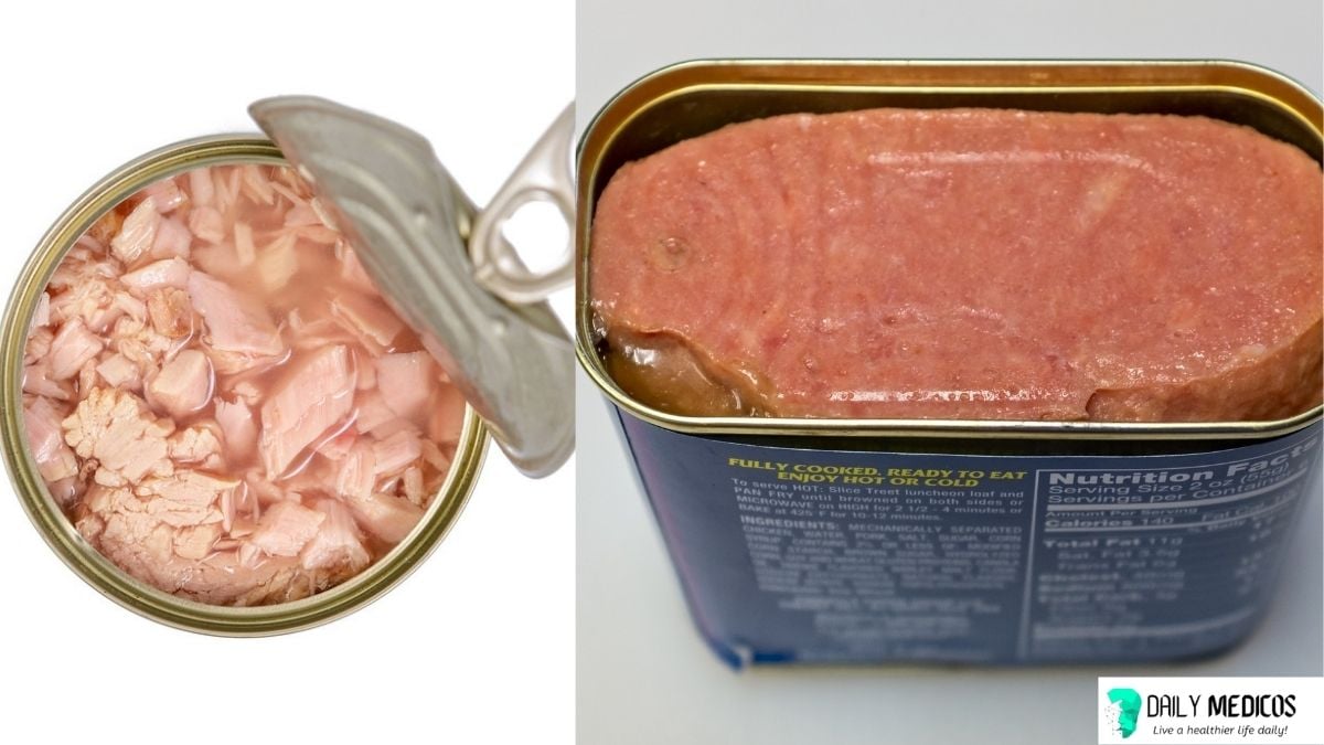 All You Need to Know About Potted Meat and its Nutritions - Daily Medicos
